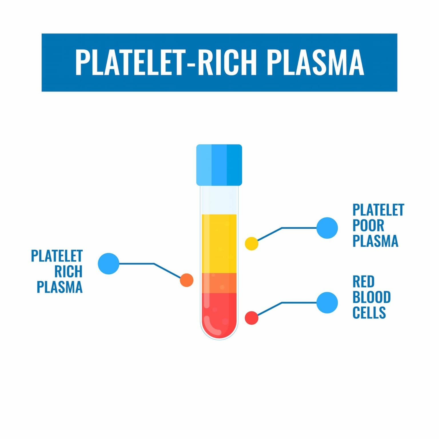PRP (Platelet Rich Plasma) Injections, Therapy and Treatment | Mr Gareth Stables | Manchester ...